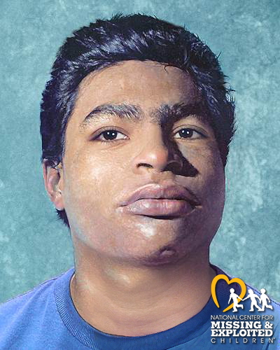Stop Child Abuse - John Doe 1980 Missing Since 30 July 1980 From Los ...